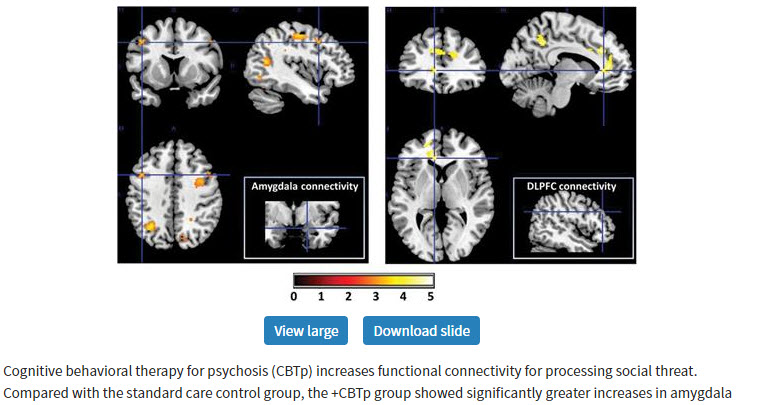 Retraining your amygdala to change your experience. | Berkshire ...